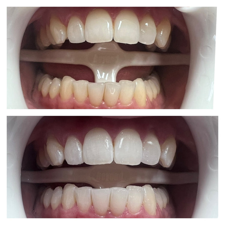 The Smile Studio - Registered Cosmetic Teeth Whitening Practitioners.